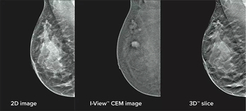 MedStar Health Offers Newest Advancement in Diagnostic Breast Imaging ...
