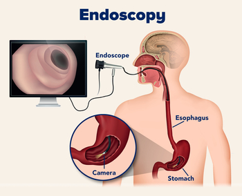 Endoscopy Images Stomach