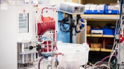 Liver Transplant Surgery | Evaluation and Process | MedStar Health