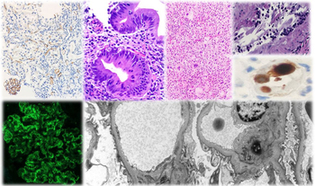 Graduates | Multi-Organ Transplantation and Hepatapancreaticobiliary ...